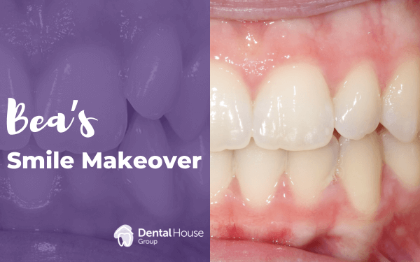 Bea of Bacchus Marsh's Invisalign Journey - Melbourne Dental House
